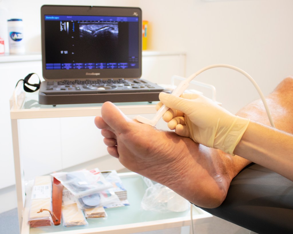 Ultrasound Guided Steroid Injections – Essex Nail Surgery and Foot Centre