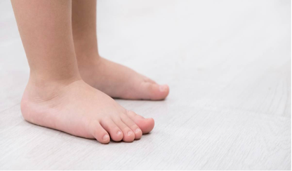 Paediatrics – Essex Nail Surgery and Foot Centre